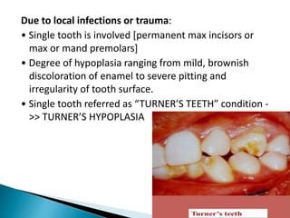 Developmental disturbances in structure of teeth | PPTX