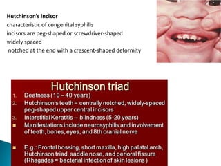 Developmental disturbances in structure of teeth | PPTX