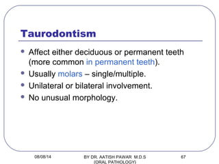 Developmental disturbances _in_teeth by dr aatish pawar MDS{oral ...