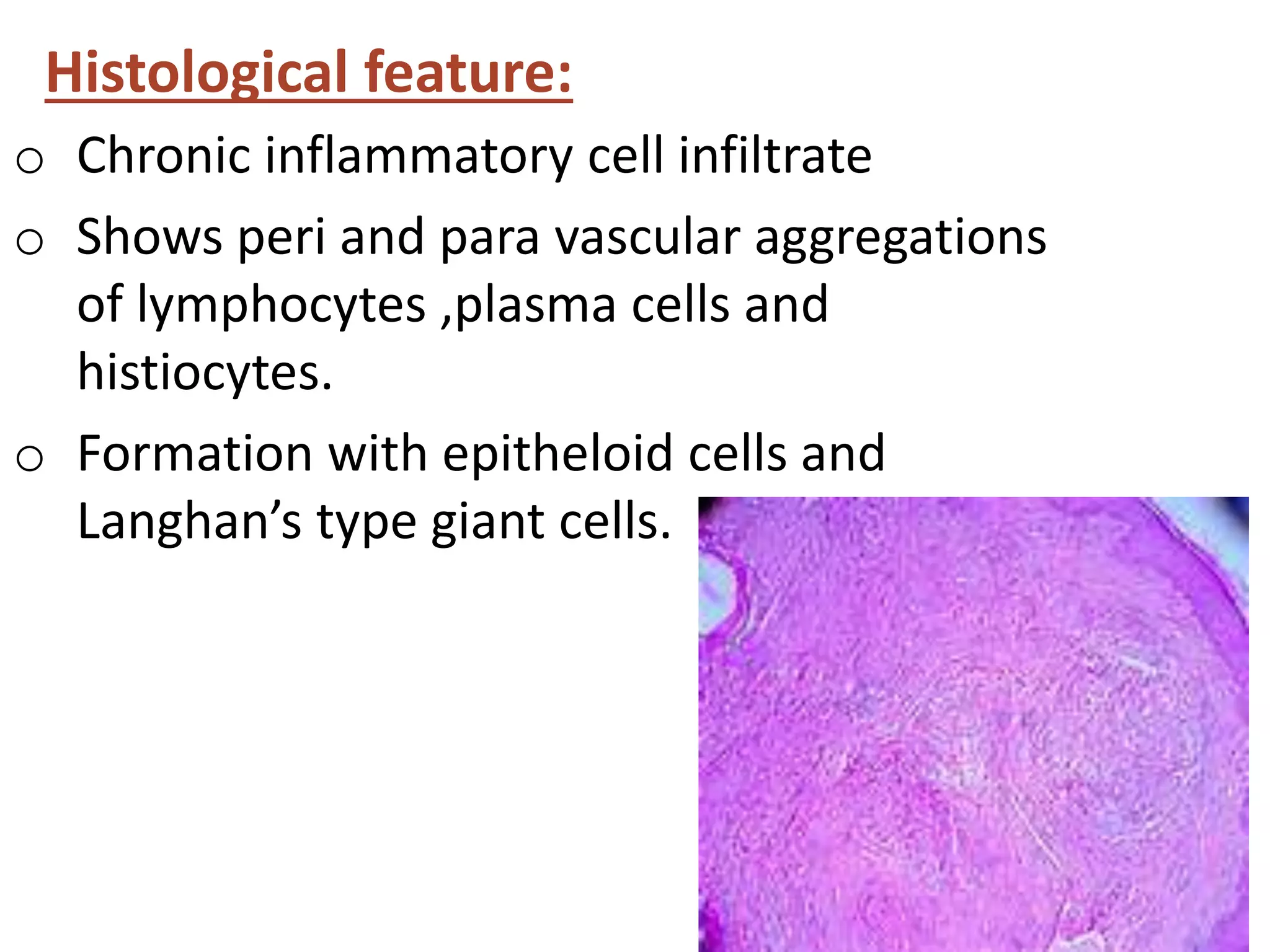 Developmental disturbances of LIP,PALATE and ORAL MUCOSA | PPTX