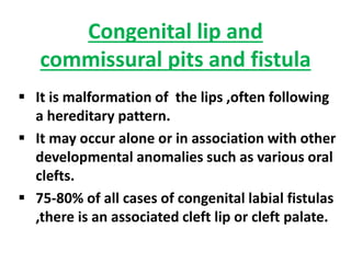 Developmental disturbances of LIP,PALATE and ORAL MUCOSA | PPTX