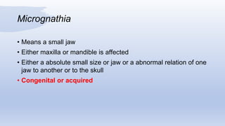 Developmental disturbances of oral and paraoral structures | PPTX