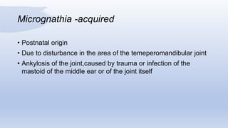 Developmental disturbances of oral and paraoral structures | PPTX