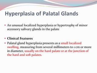 DEVELOPMENTAL DISTURBANCES OF SALIVARY GLAND.pptx
