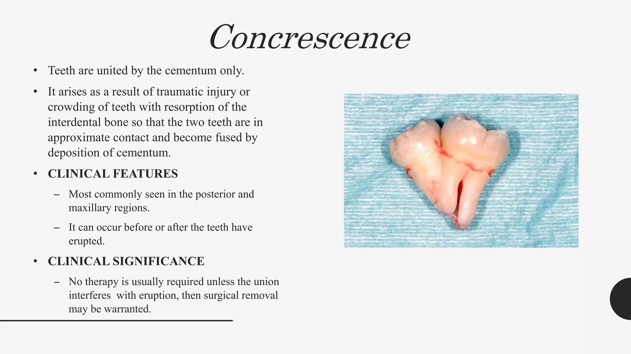 Developmental disturbances of teeth | PPTX