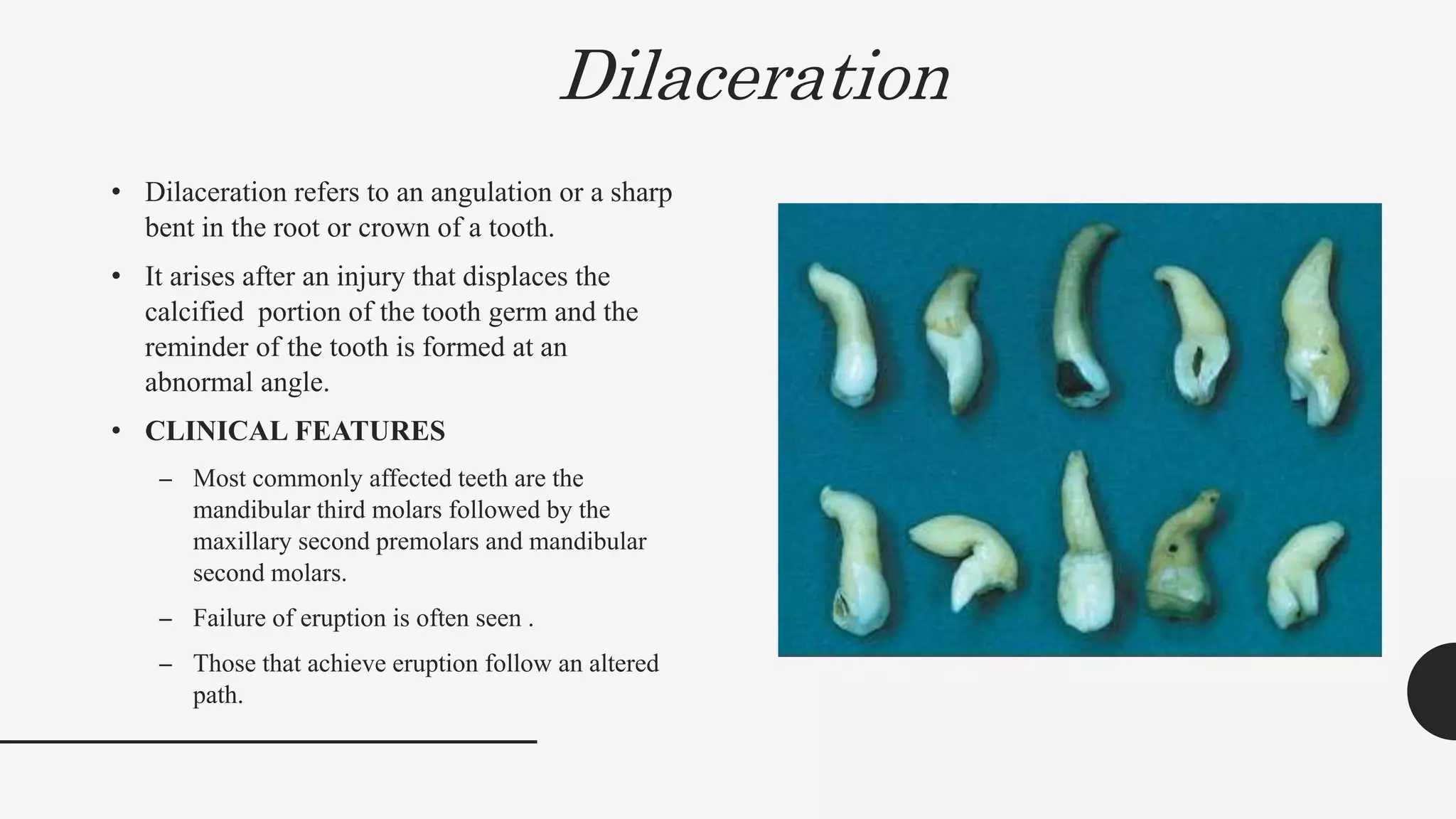 Developmental disturbances of teeth | PPTX