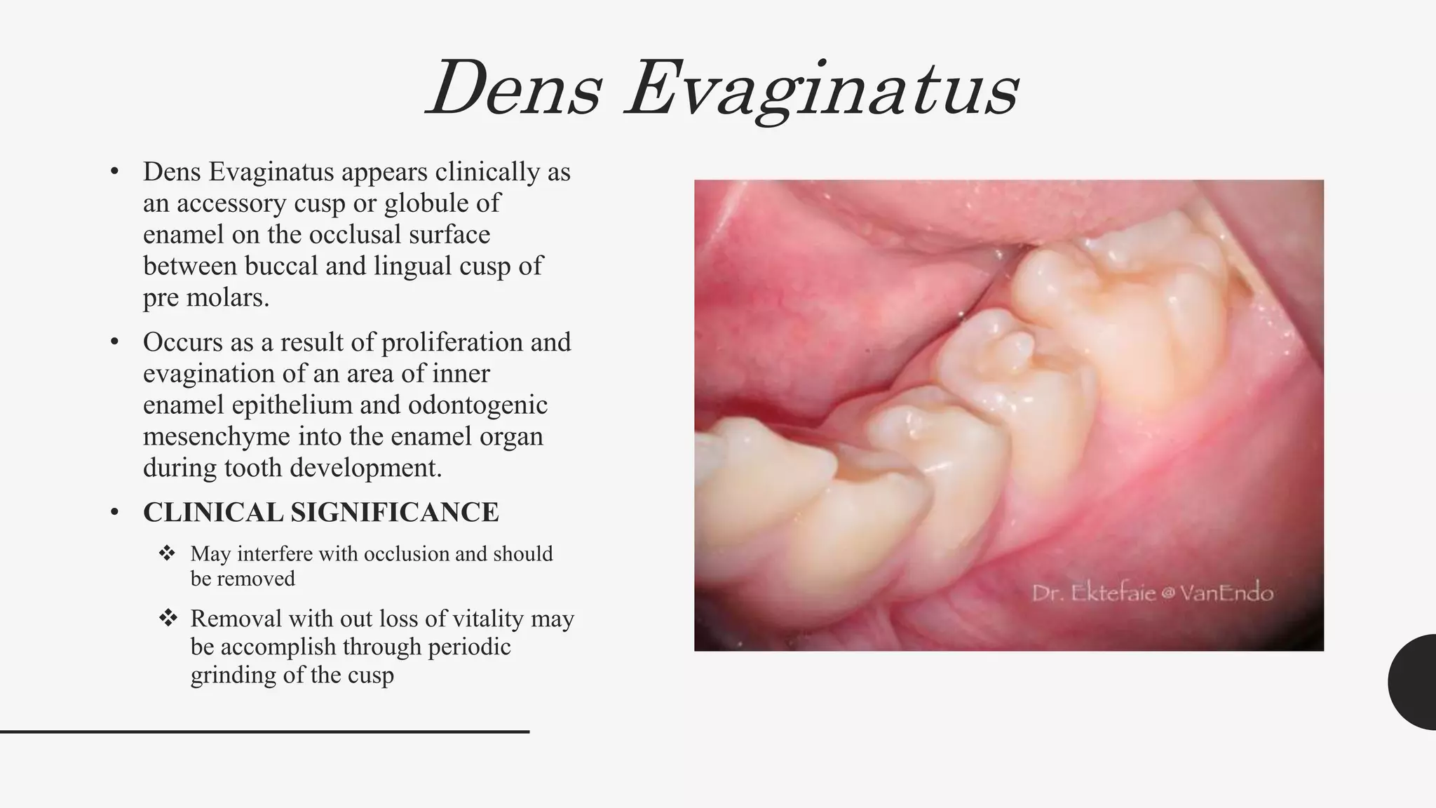 Developmental disturbances of teeth | PPTX