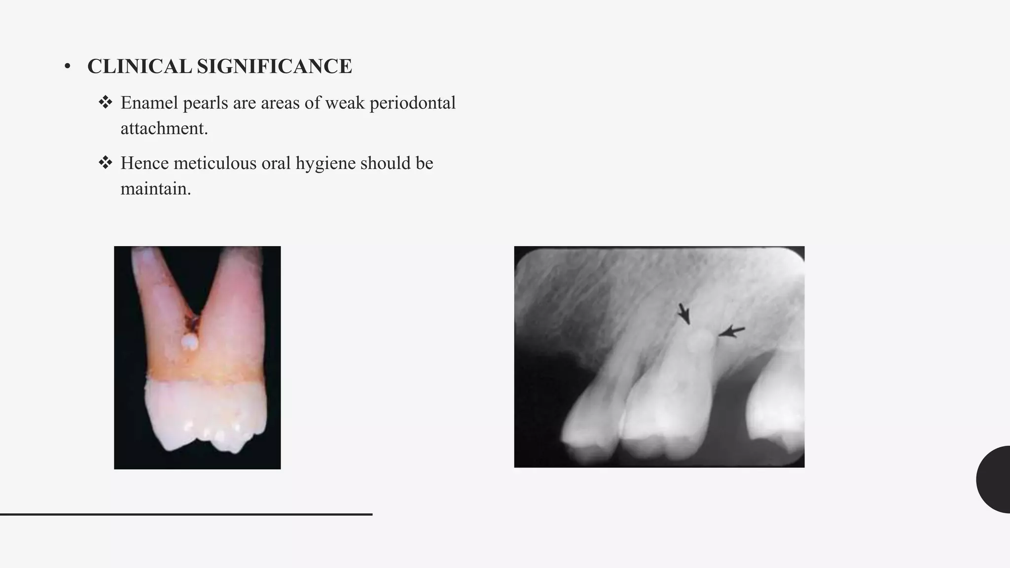 Developmental disturbances of teeth | PPTX