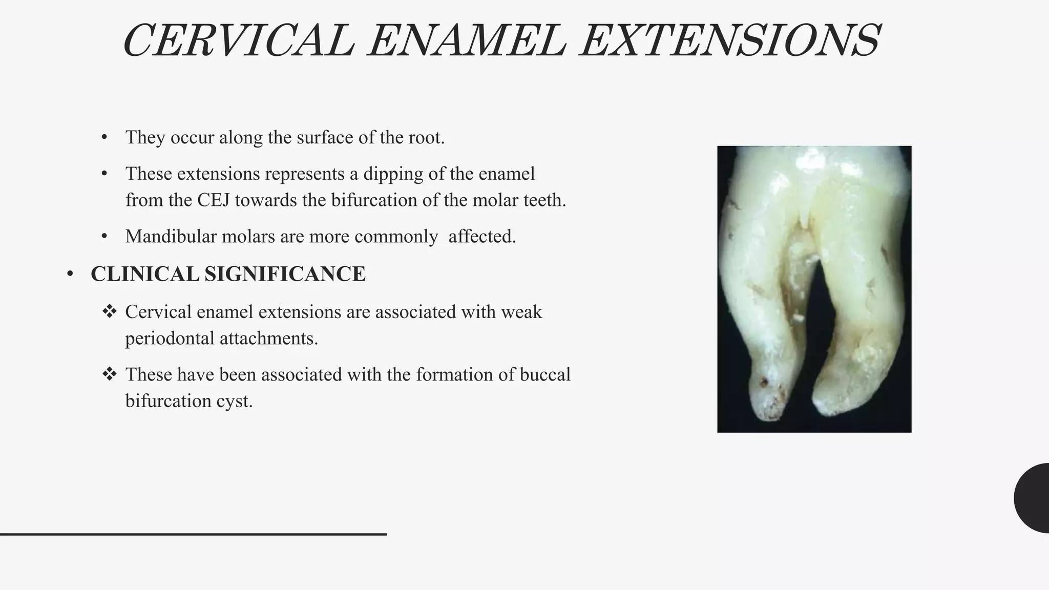 Developmental disturbances of teeth | PPTX