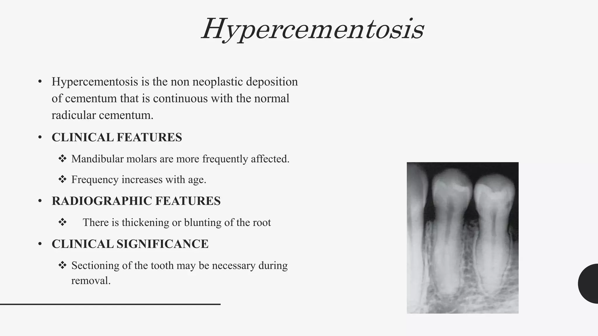 Developmental disturbances of teeth | PPTX