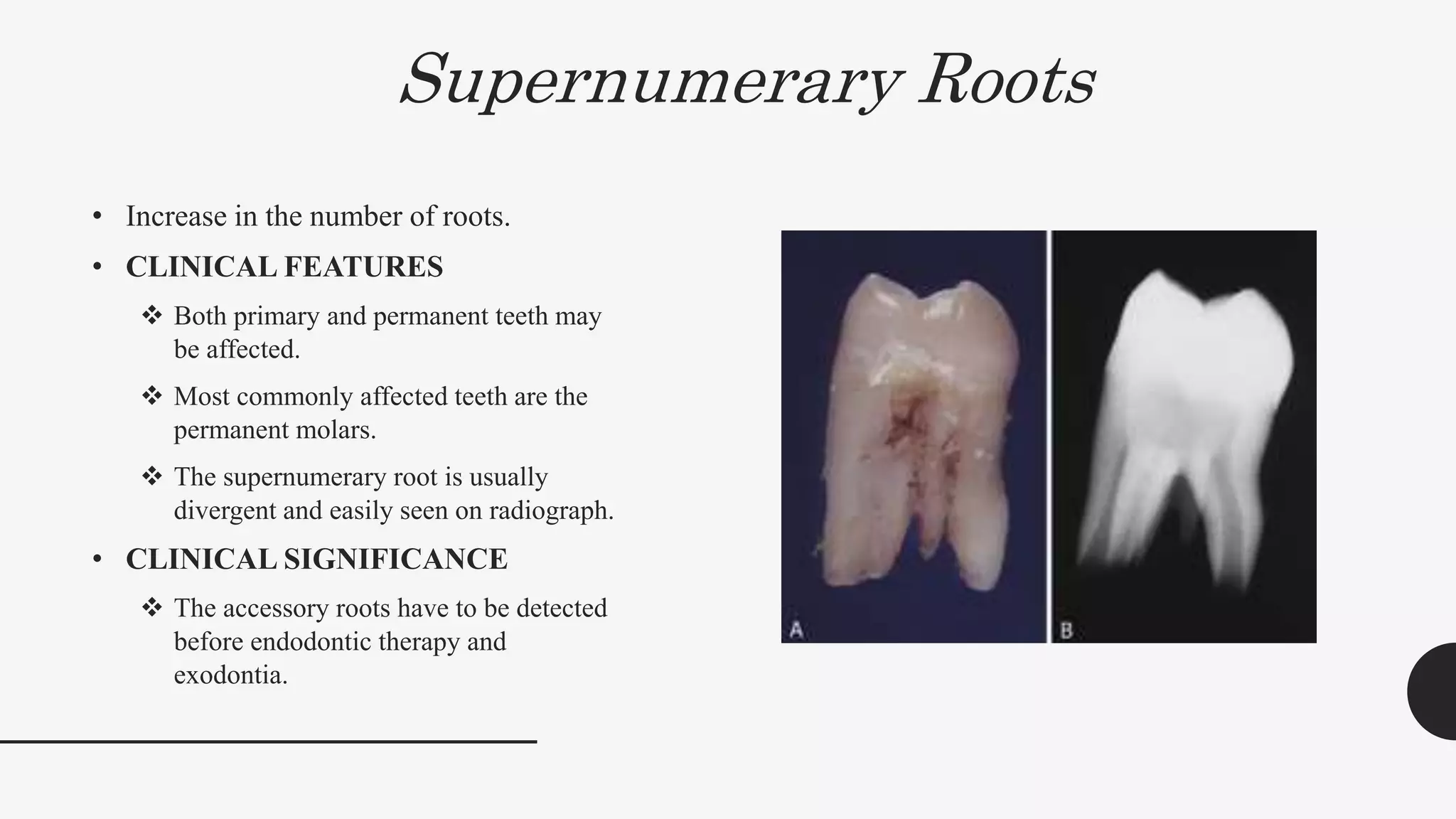 Developmental disturbances of teeth | PPTX