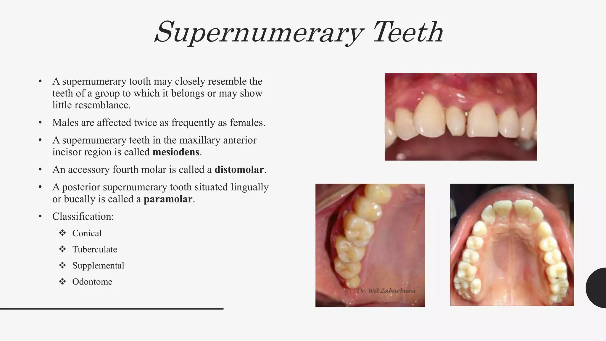 Developmental disturbances of teeth | PPTX