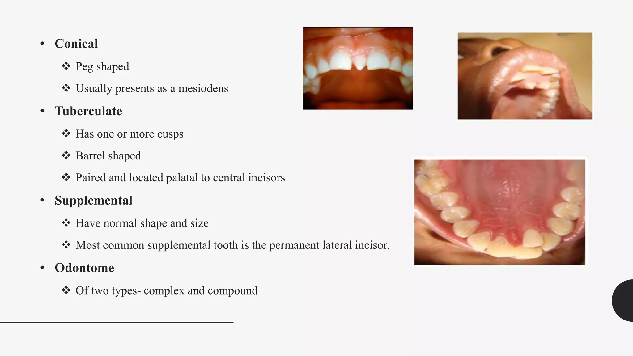 Developmental disturbances of teeth | PPTX