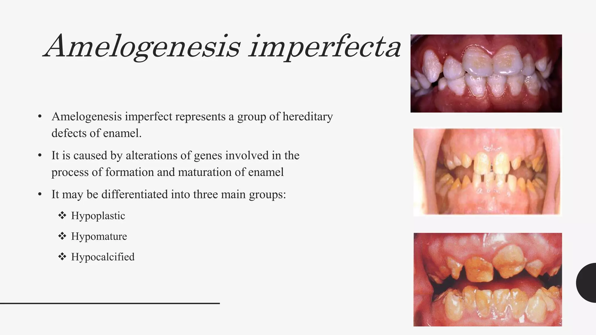 Developmental disturbances of teeth | PPTX