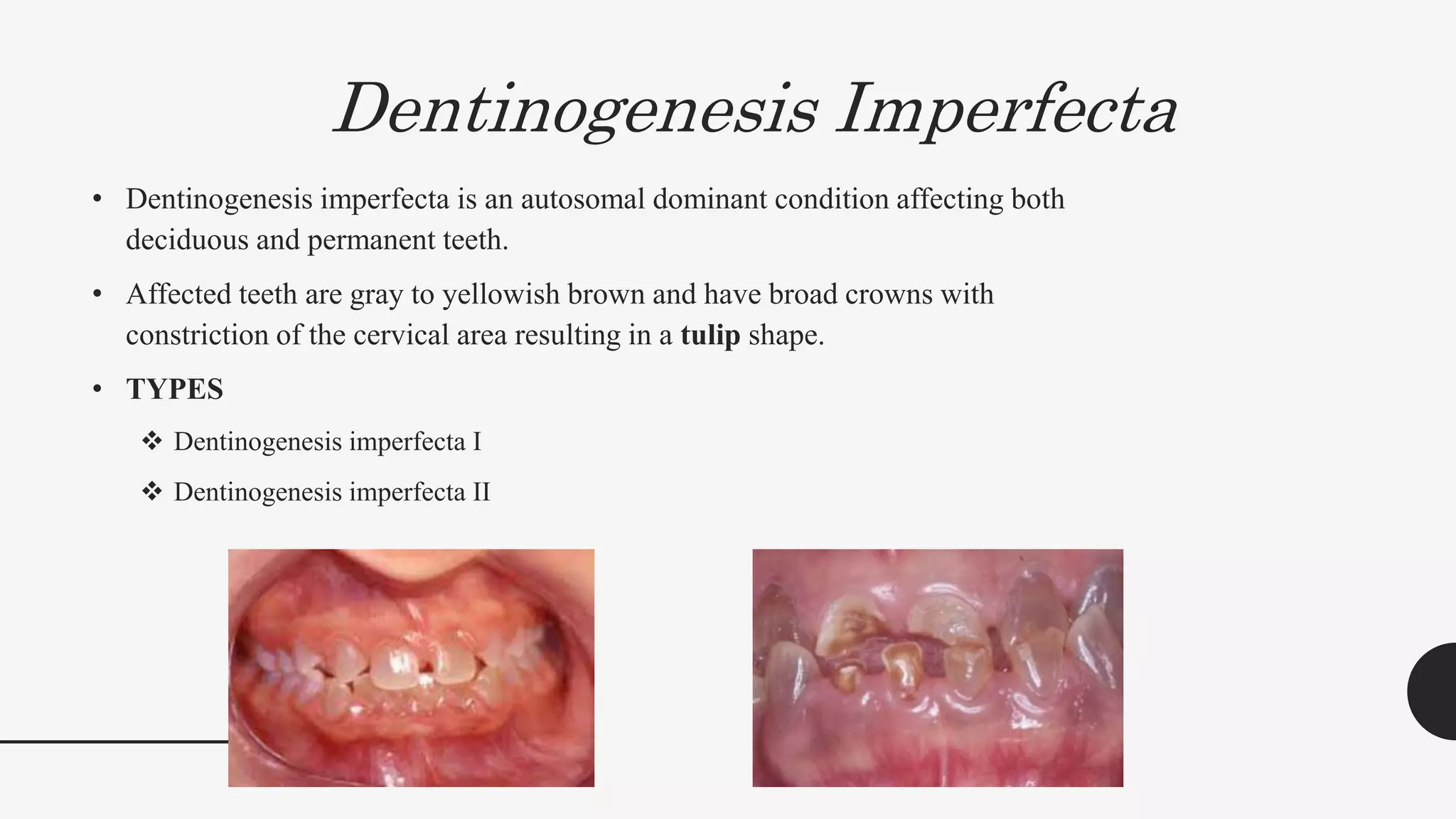 Developmental disturbances of teeth | PPTX