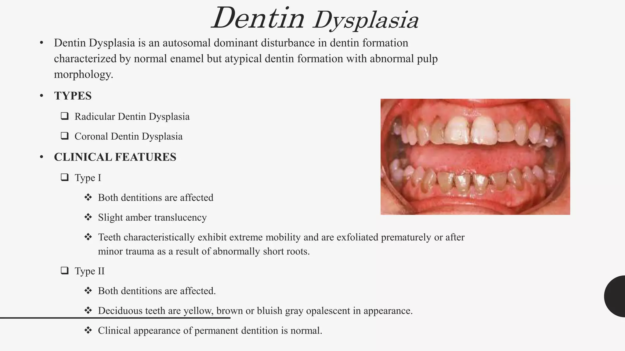 Developmental disturbances of teeth | PPTX