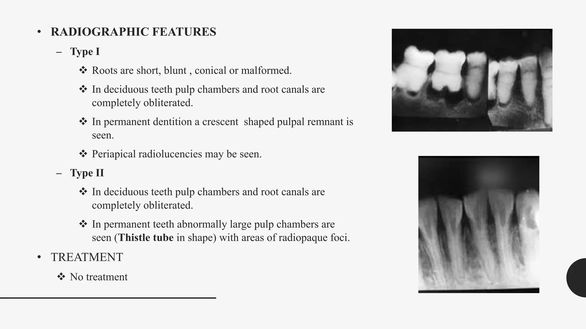 Developmental disturbances of teeth | PPTX