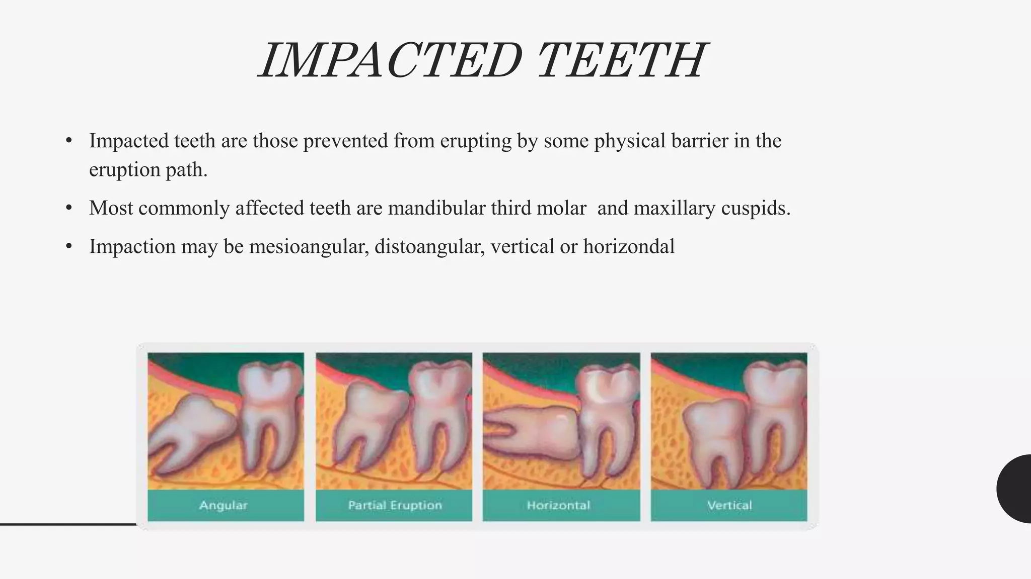 Developmental disturbances of teeth | PPTX