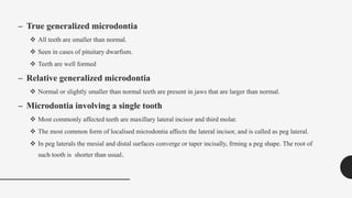 Developmental disturbances of teeth | PPTX