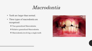 Developmental disturbances of teeth | PPTX