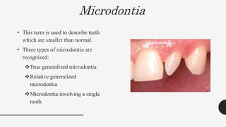 True Generalized Microdontia
