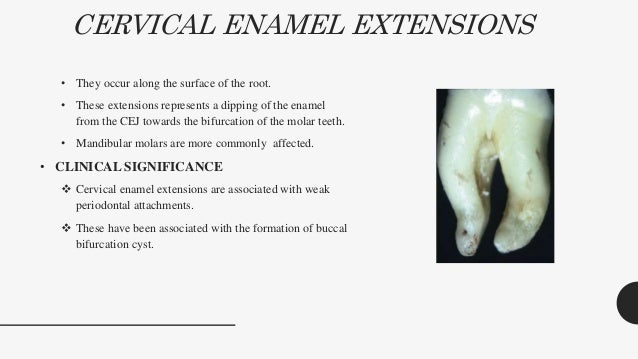 Developmental disturbances of teeth