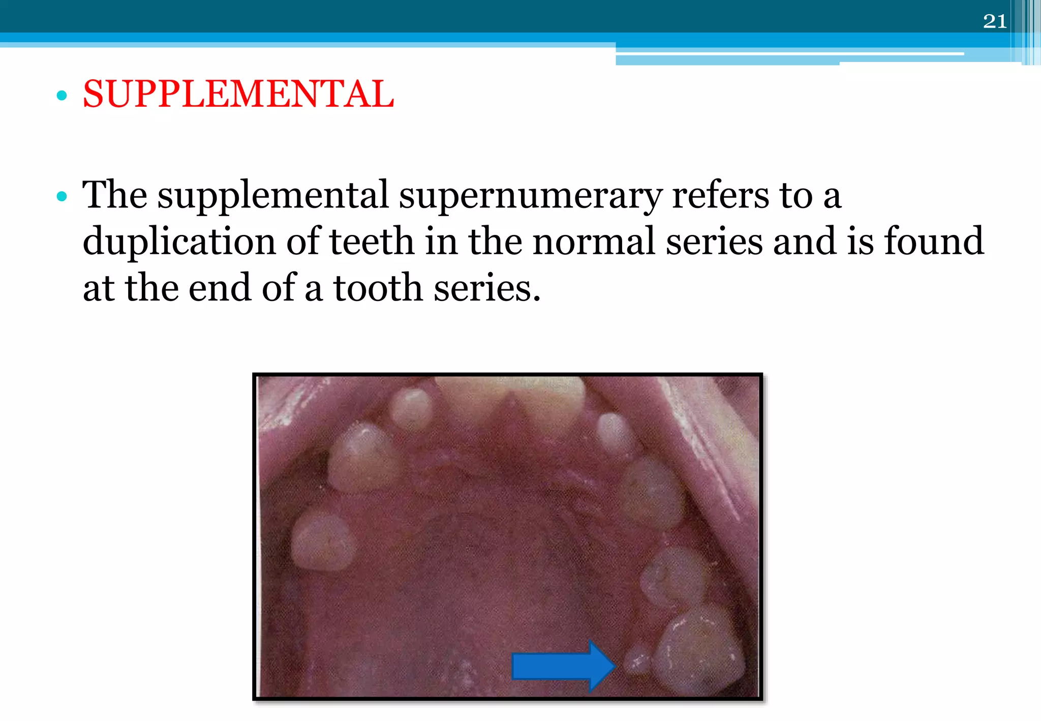 developmental disturbances of teeth.pptx