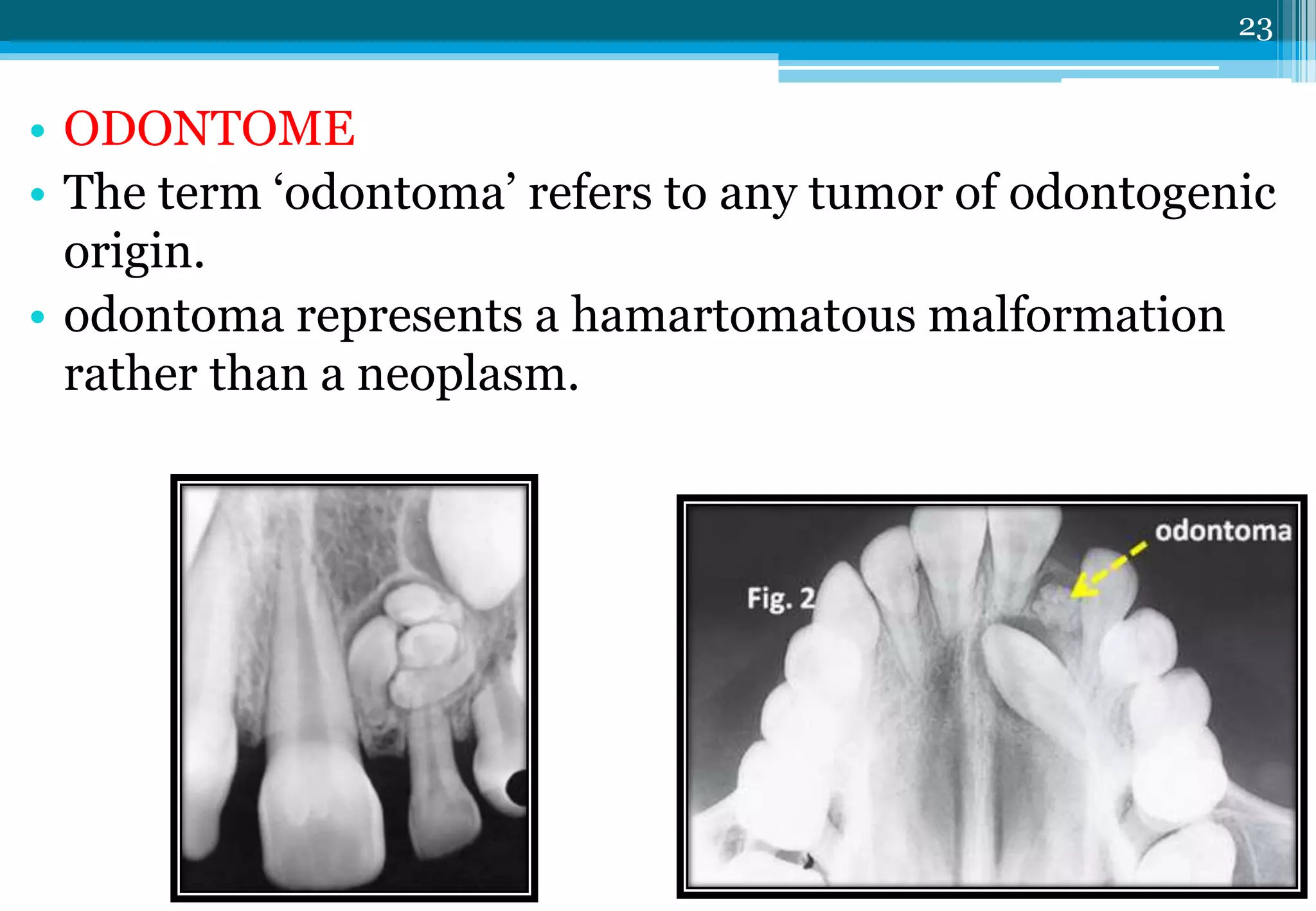 developmental disturbances of teeth.pptx