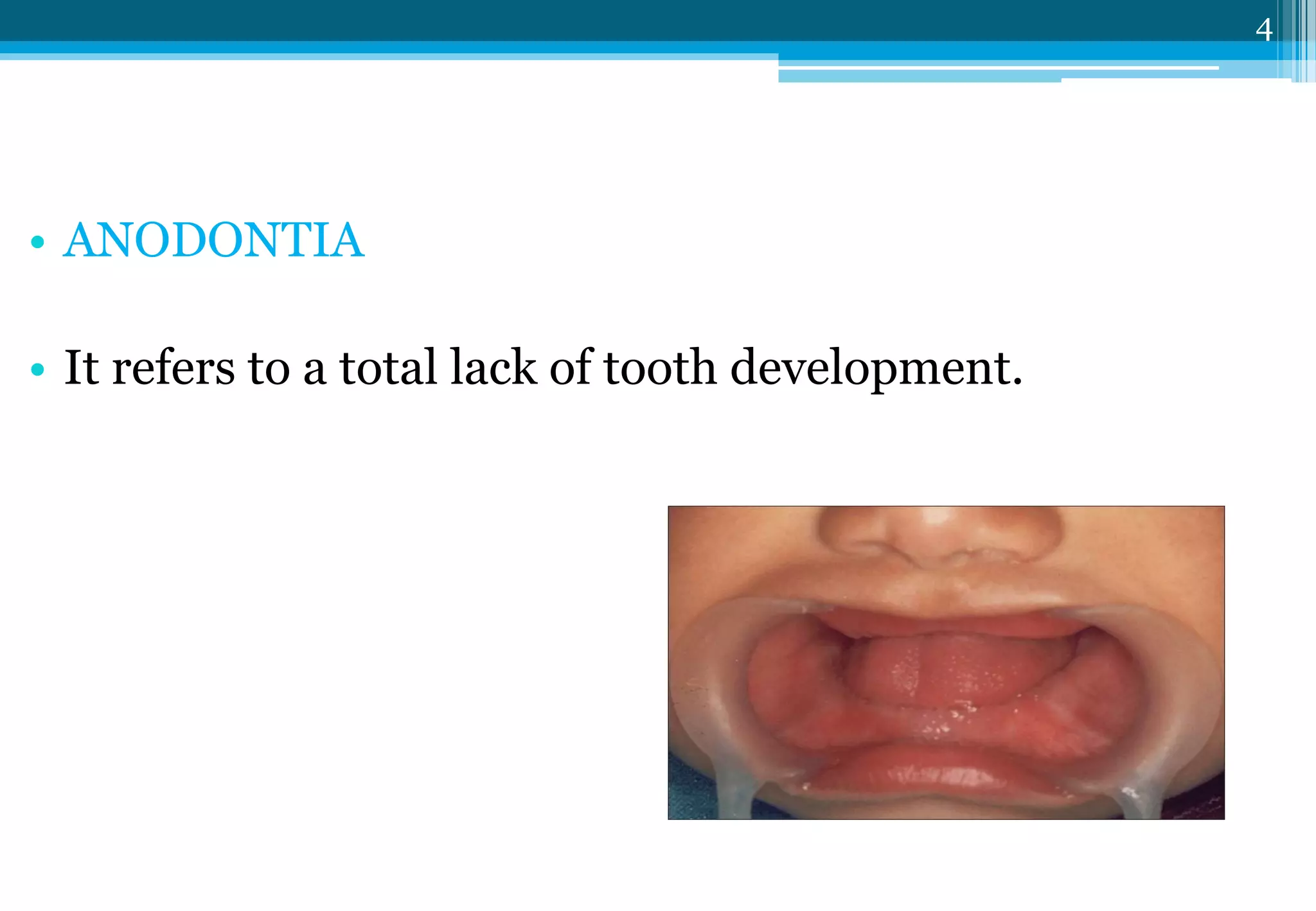 developmental disturbances of teeth.pptx