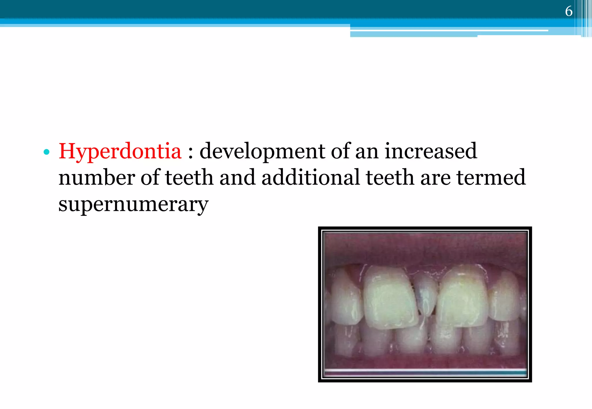 developmental disturbances of teeth.pptx
