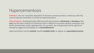 Developmental disturbances of teeth and bone | PPTX