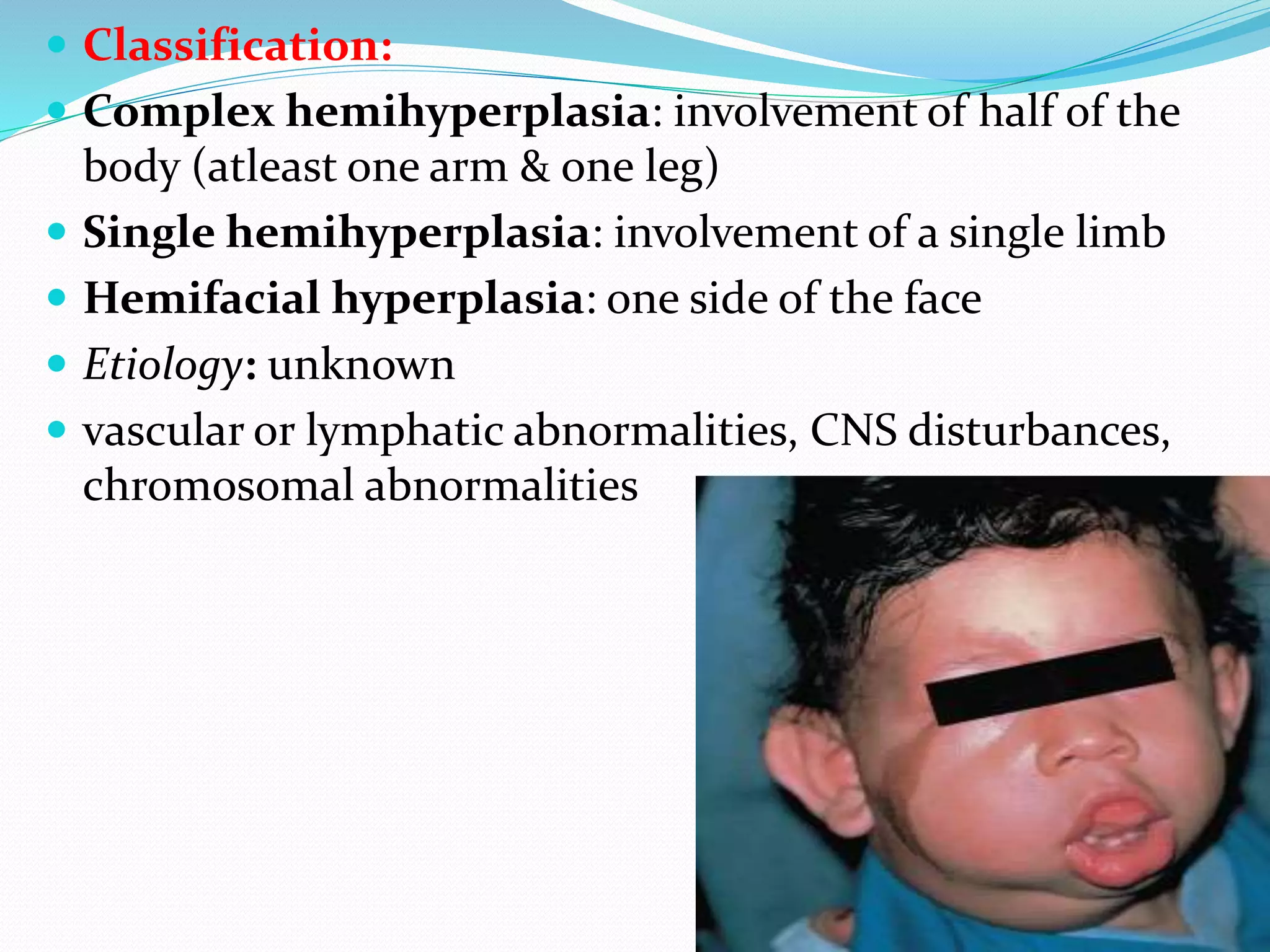 Developmental disturbances of the jaws | PPTX