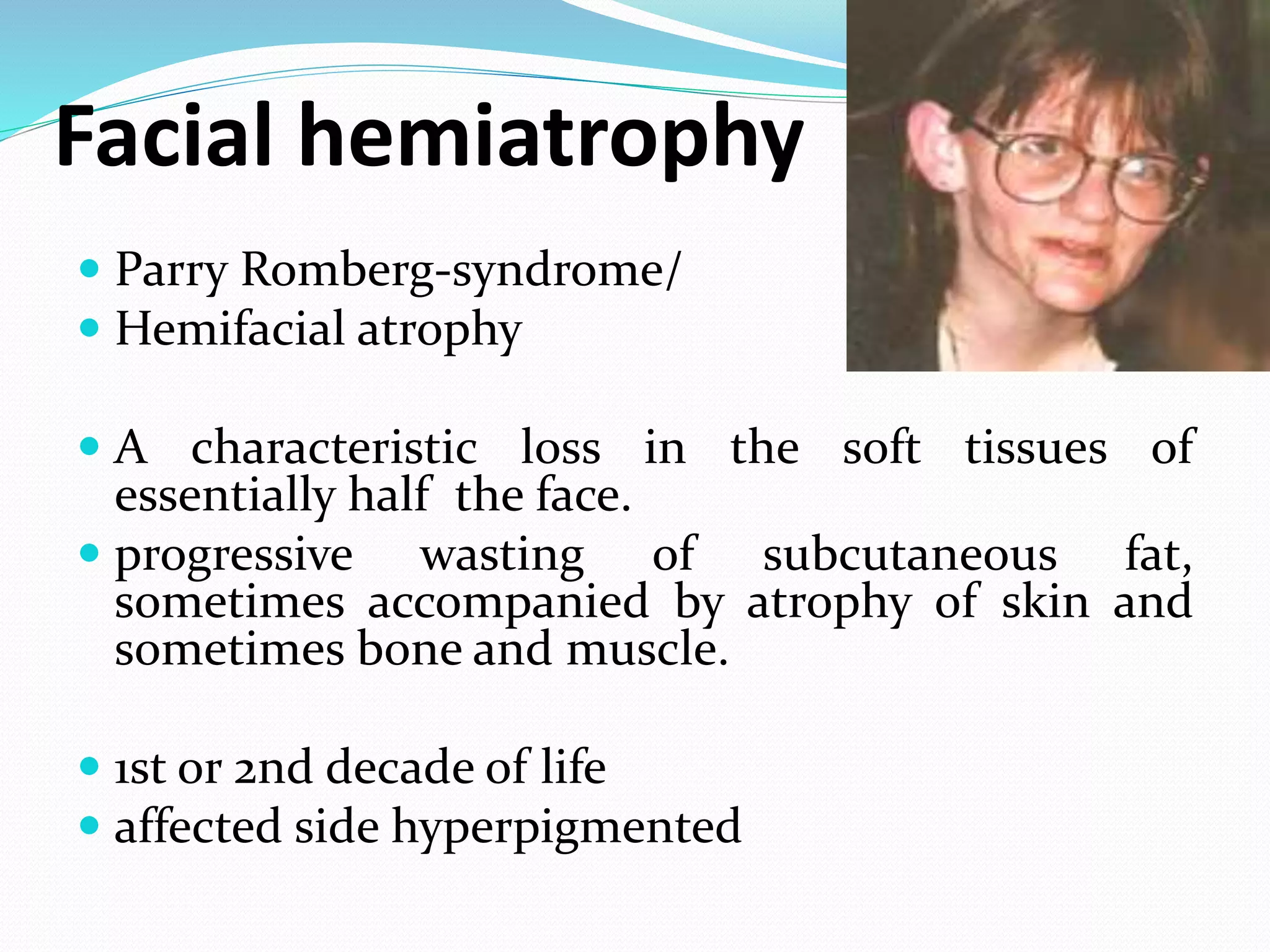 Developmental disturbances of the jaws | PPTX