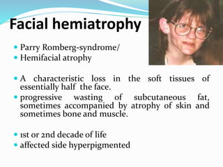 Developmental disturbances of the jaws | PPTX