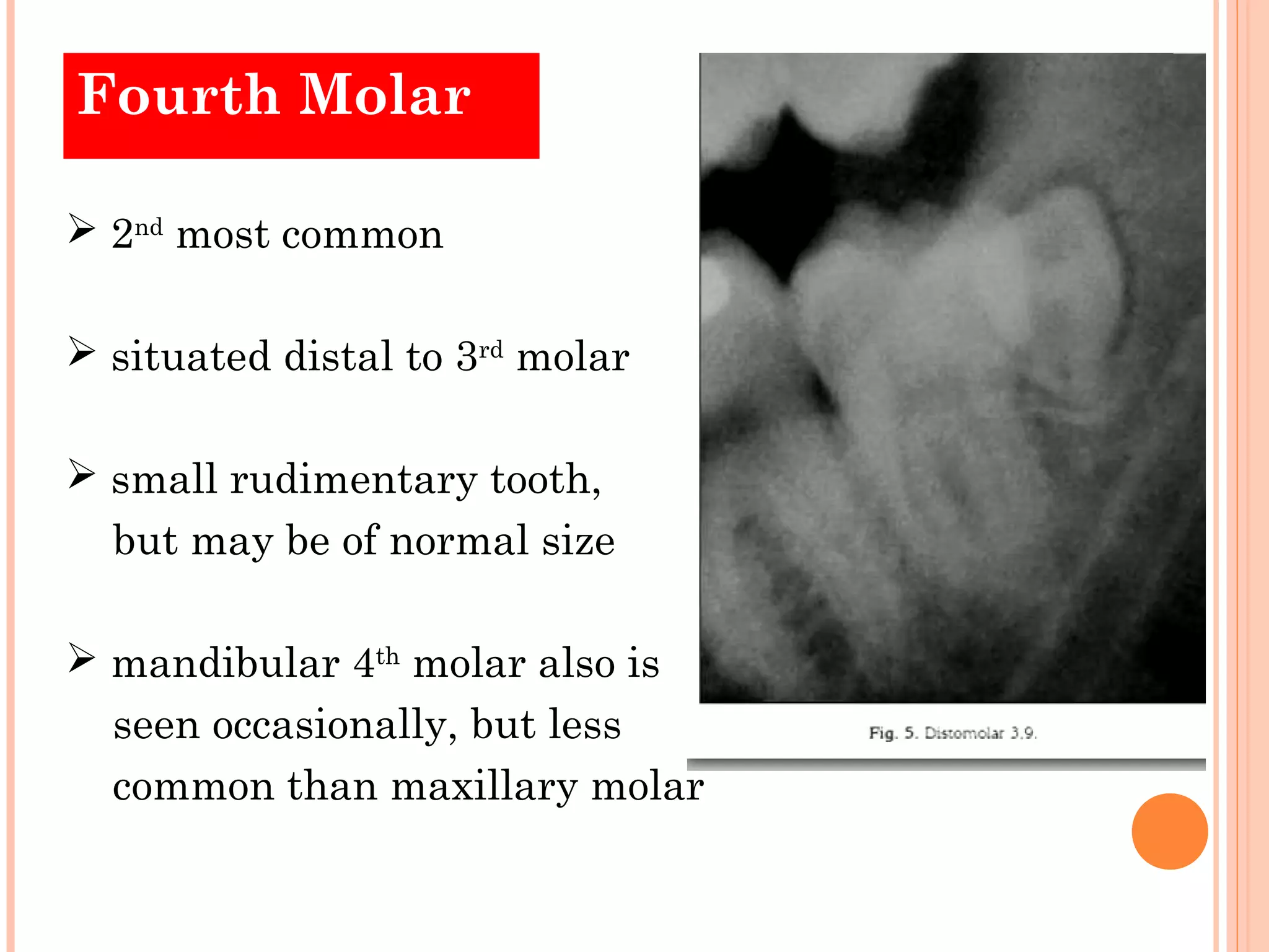 Developmental disturbances of the Teeth | PPT