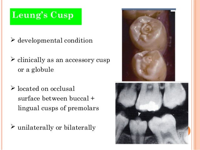 Developmental disturbances of the Teeth