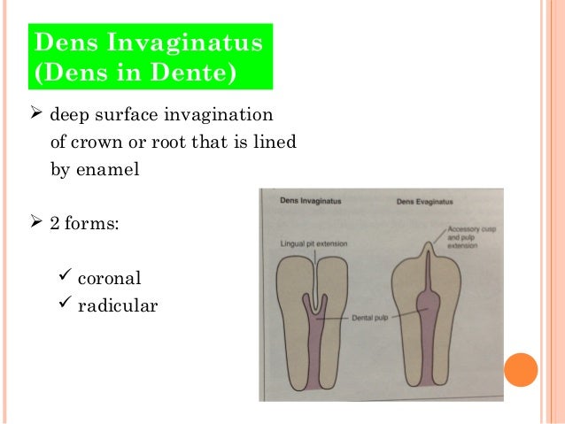 Developmental disturbances of the Teeth