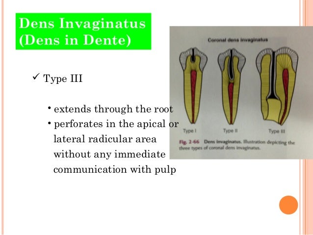 Developmental disturbances of the Teeth