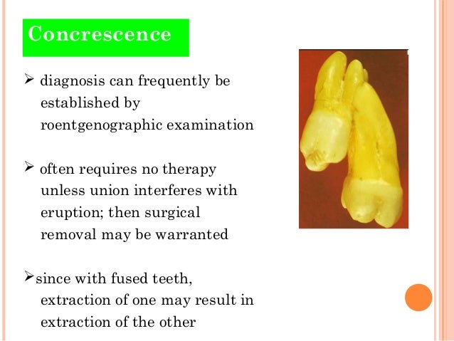 Developmental disturbances of the Teeth