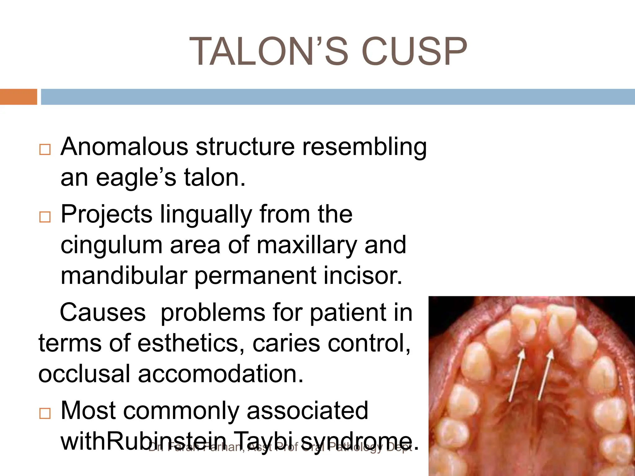 DEVELOPMENTAL DISTURBANCES OF THE TEETH. LEC 2.pptx