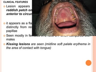 Developmental disturbances of tongue | PPTX