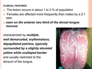 Developmental disturbances of tongue | PPTX