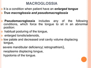 Developmental disturbances of tongue | PPTX