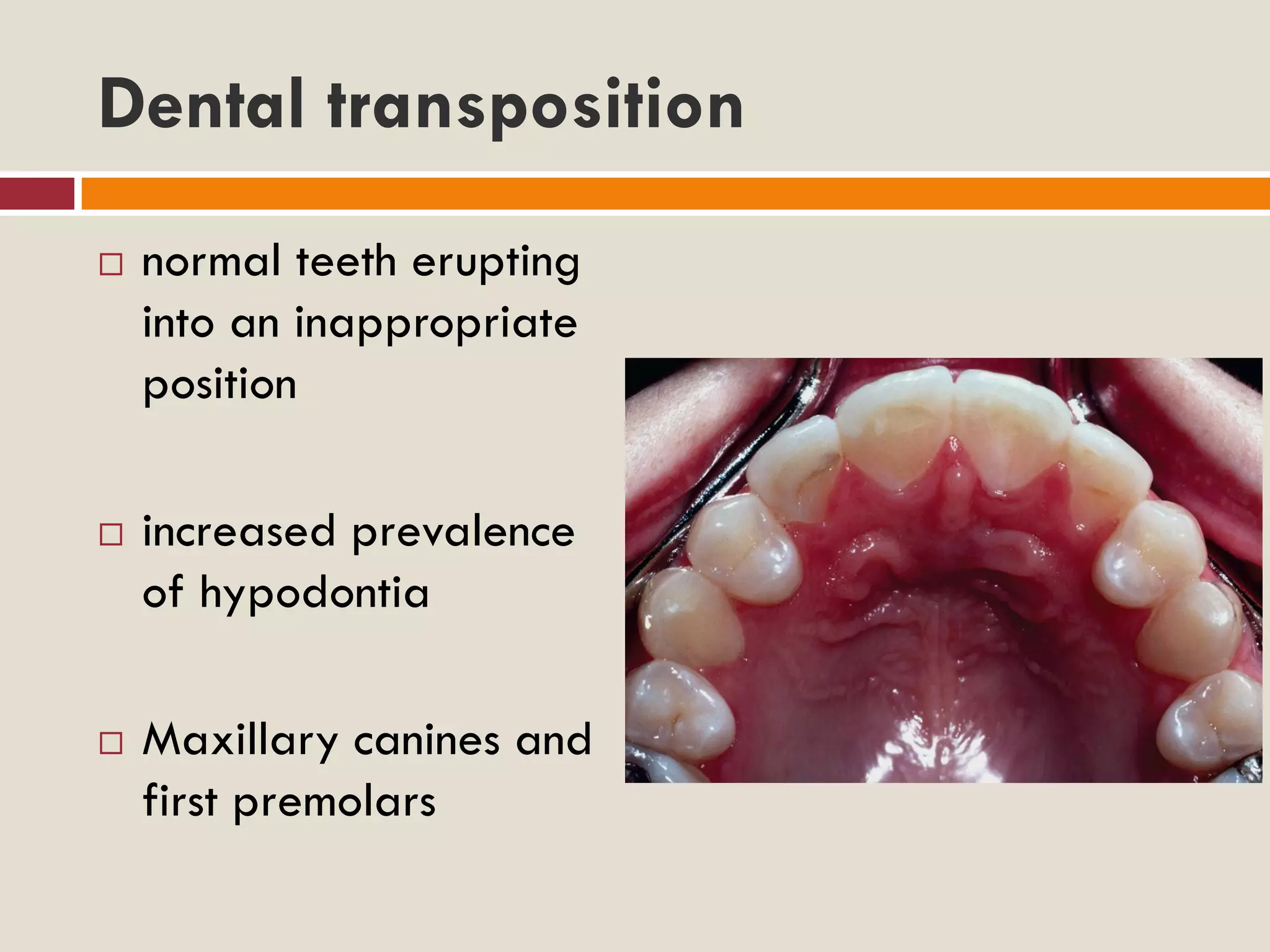 Developmental disturbances of tooth morphology | PPT
