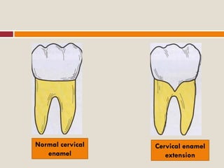 Developmental disturbances of tooth morphology | PDF