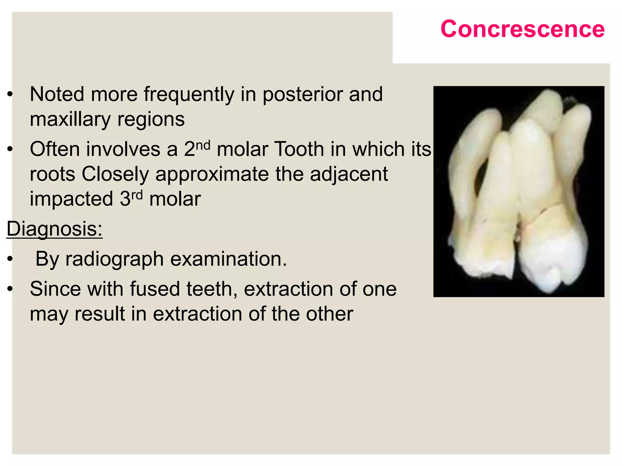 Developmental disturbances shape, size and number of the teeth | PPTX