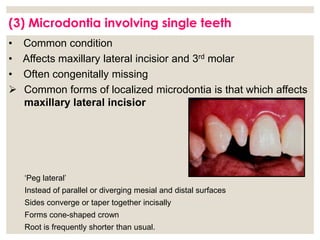 Developmental disturbances shape, size and number of the teeth | PPTX