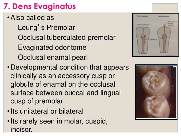 Developmental disturbances shape, size and number of the teeth
