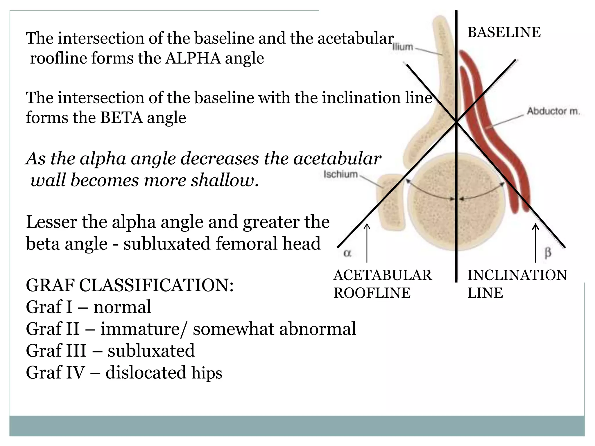 Developmental dyspalsia of hip | PPTX