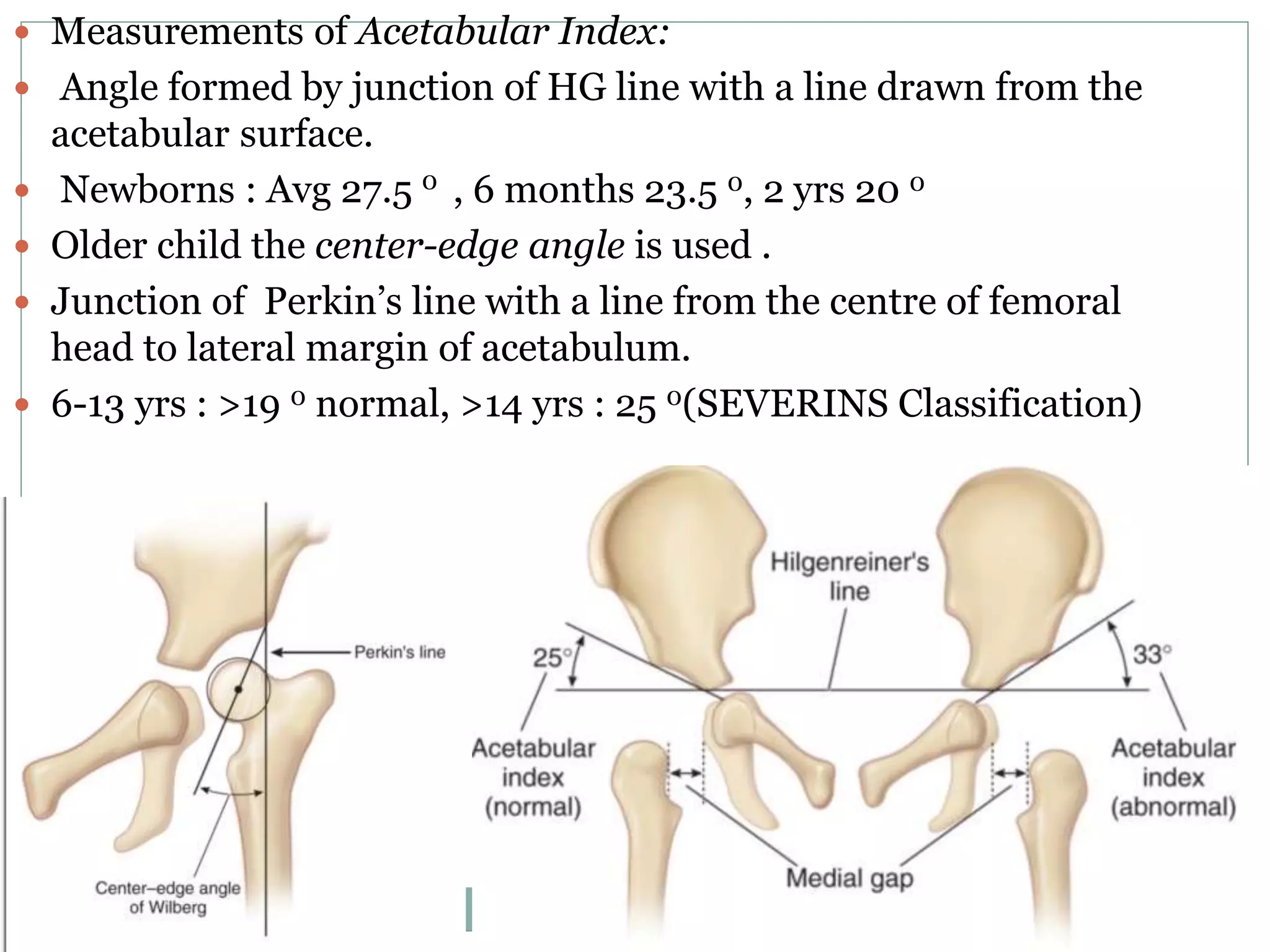 Developmental Dyspalsia Of Hip Pptx